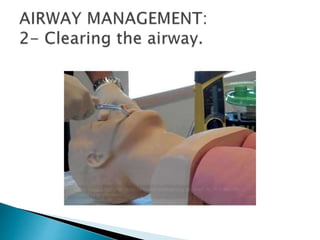 Airway management | PPTX