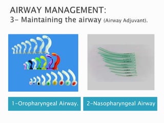 Airway management | PPTX