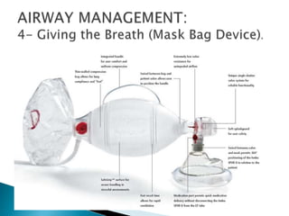 Airway management | PPTX