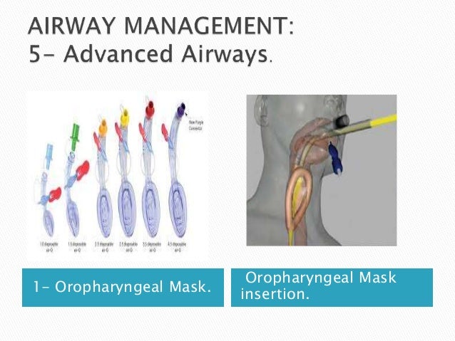 Airway management