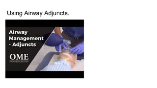 Airway management | PPTX