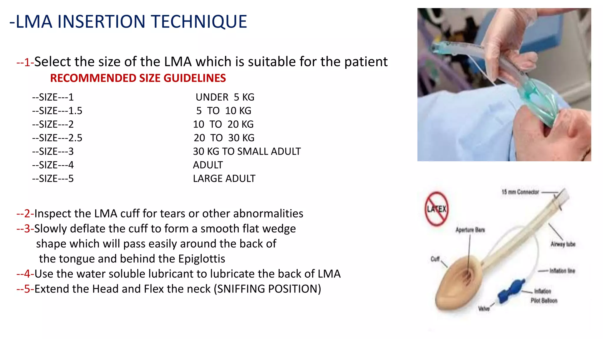 Airway management | PPTX