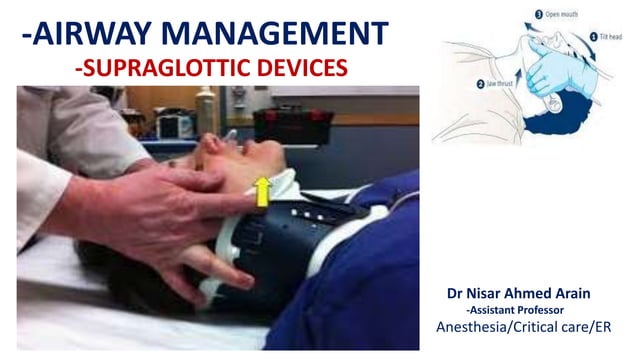 Airway management | PPT