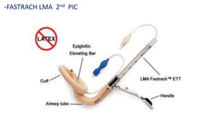 Airway management | PPT