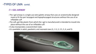 Airway management | PPTX