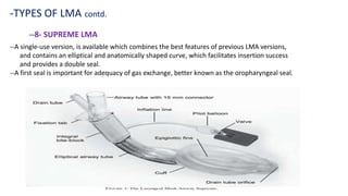 Airway management | PPT