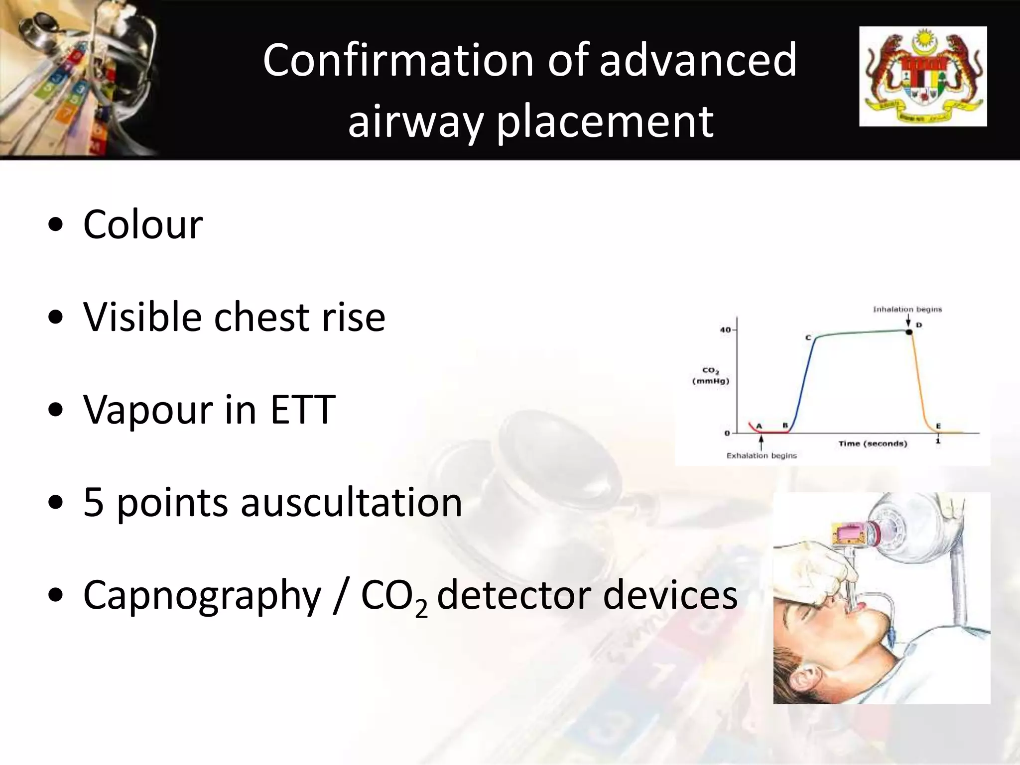 Airway management | PPTX