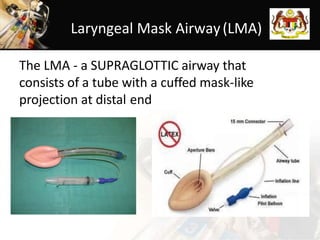 Airway management | PPTX