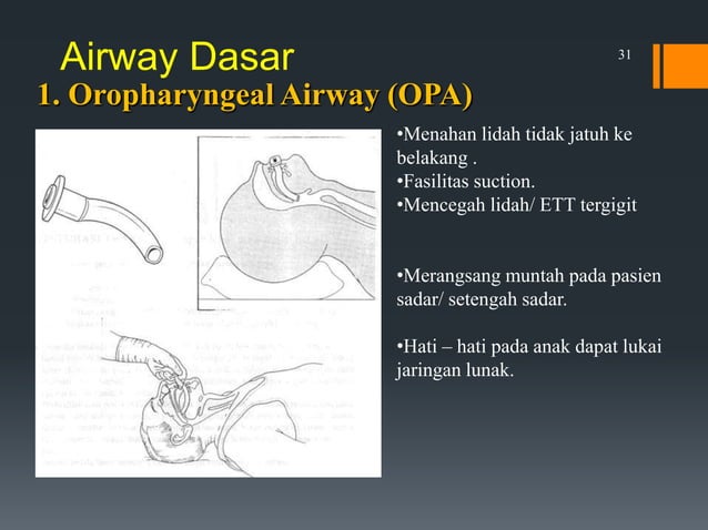 AIRWAY MANAGEMENT.pdf