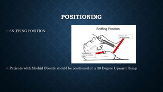 Airway Management.pptx