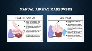 Airway Management.pptx