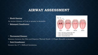 Airway Management.pptx