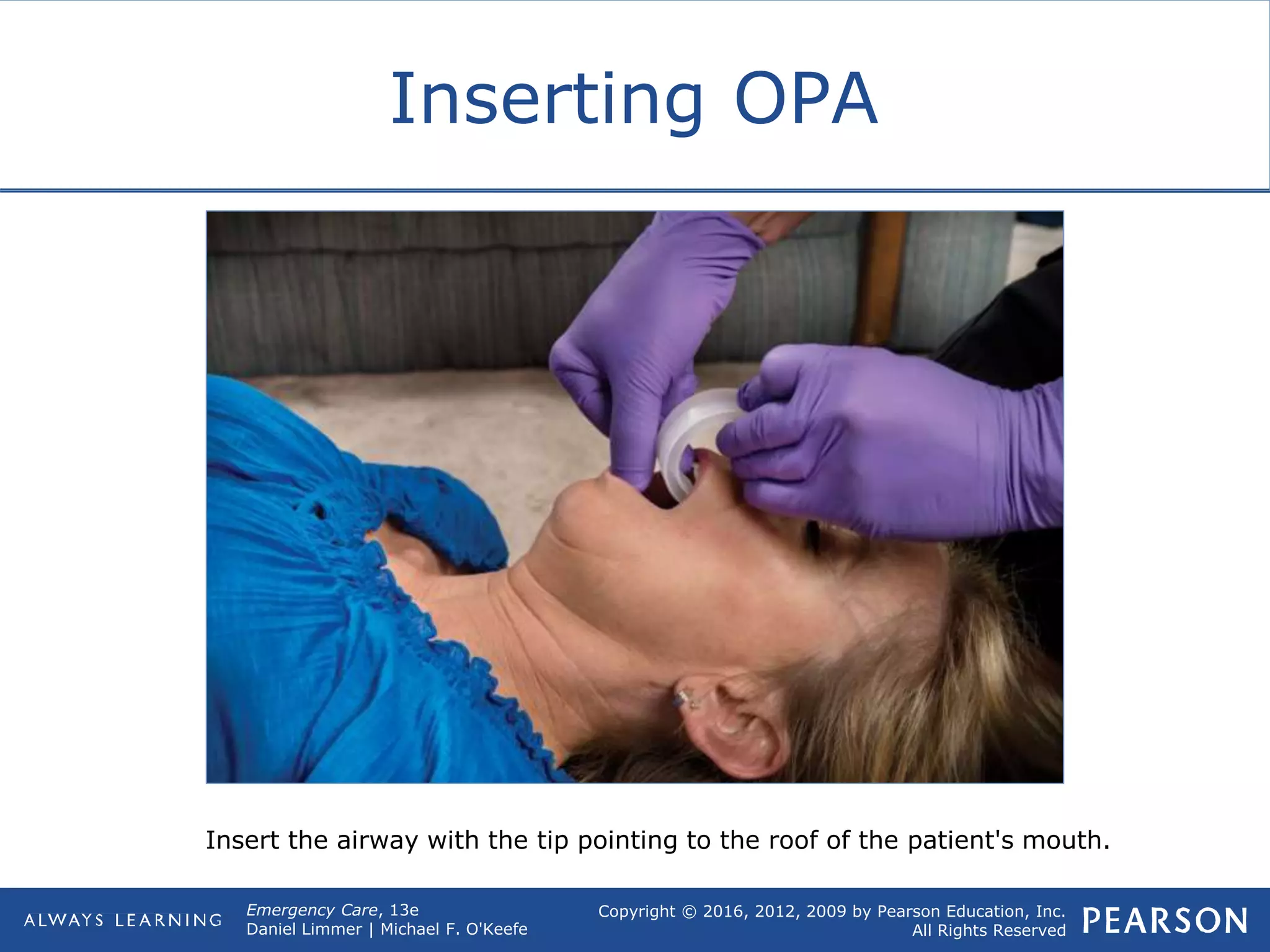 Airway Management.ppt