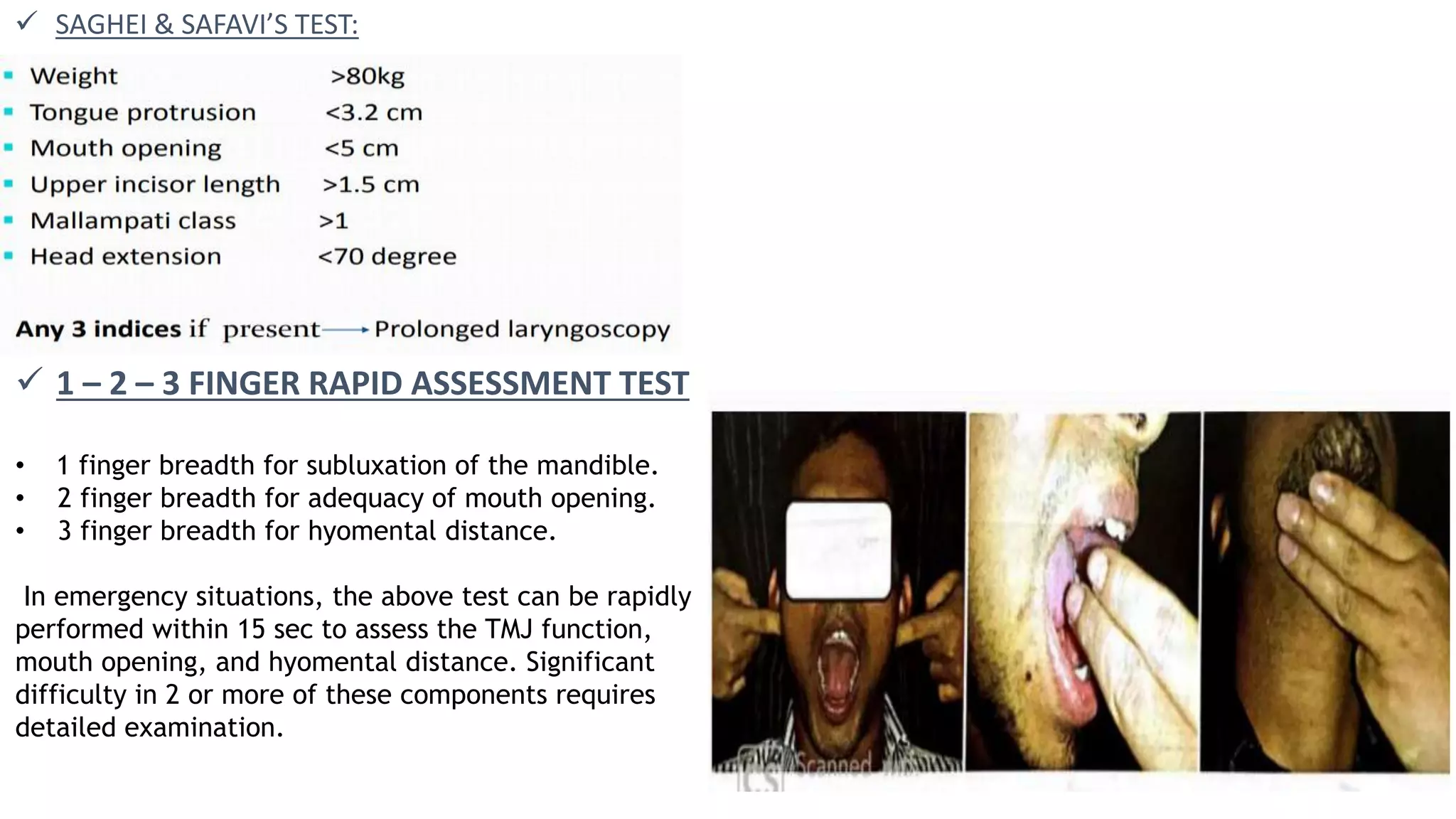 Airway management.pptx