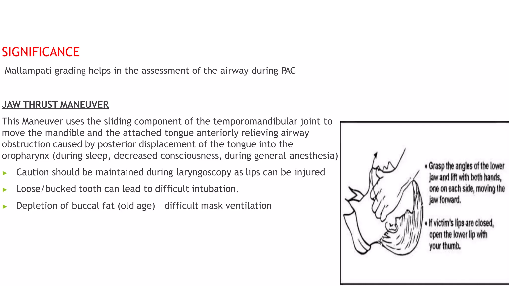 Airway management.pptx