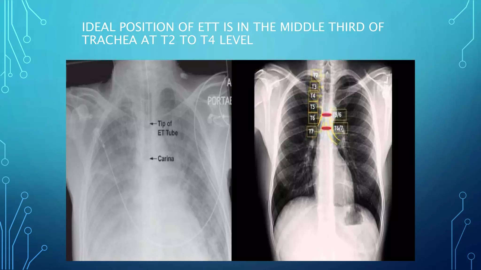 Airway Management.pptx