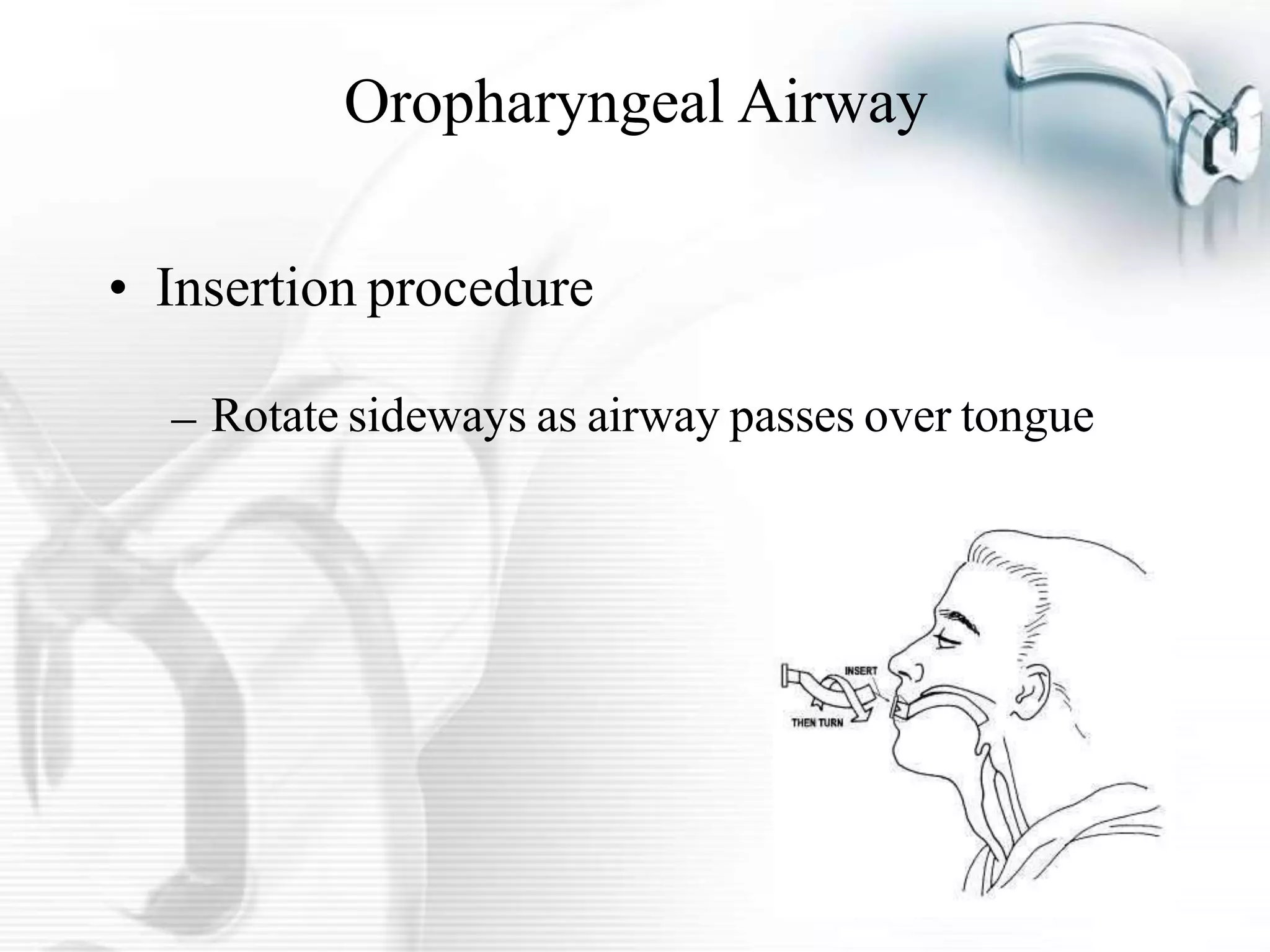 AIRWAY Management.ppt