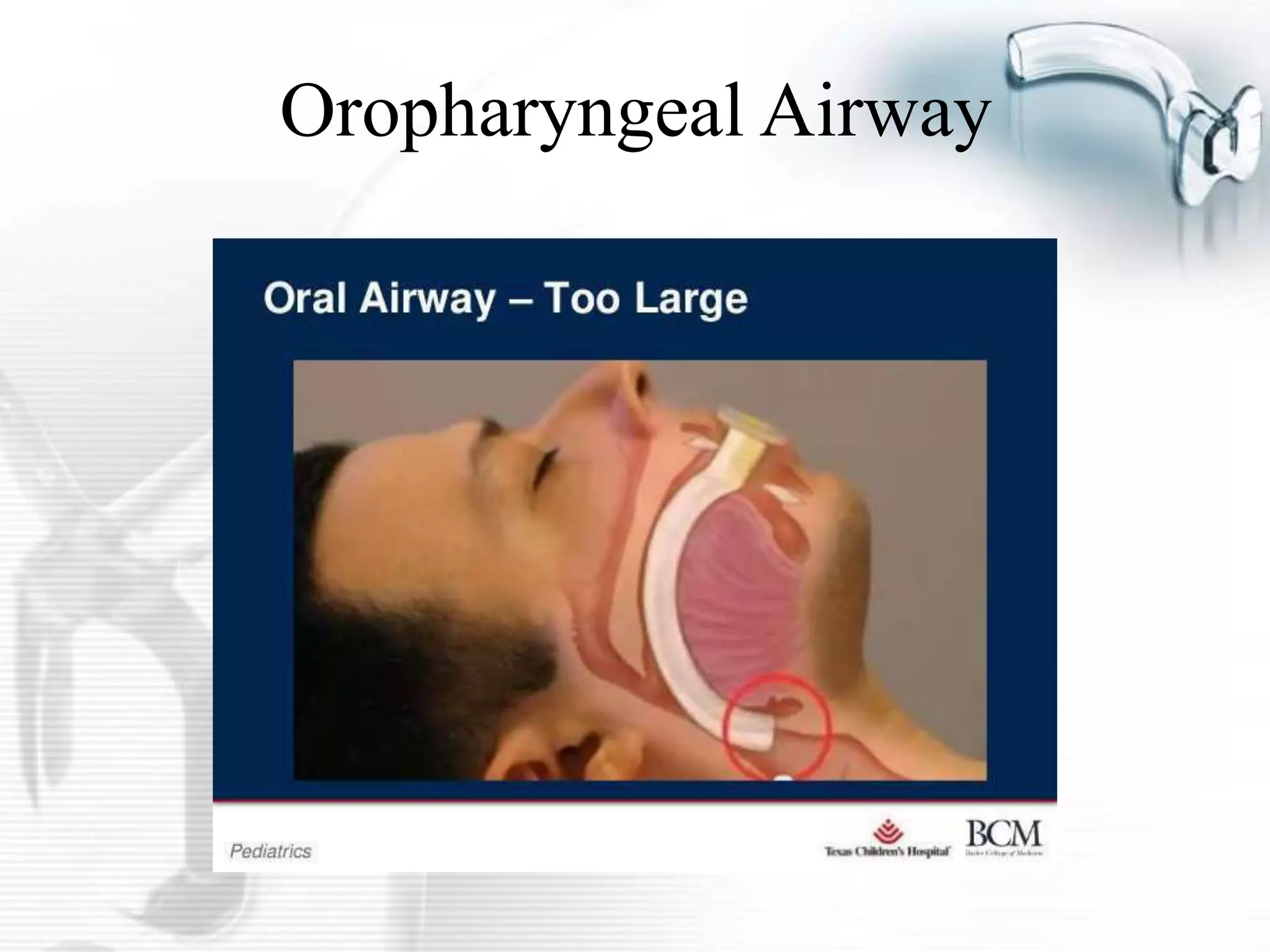 AIRWAY Management.ppt