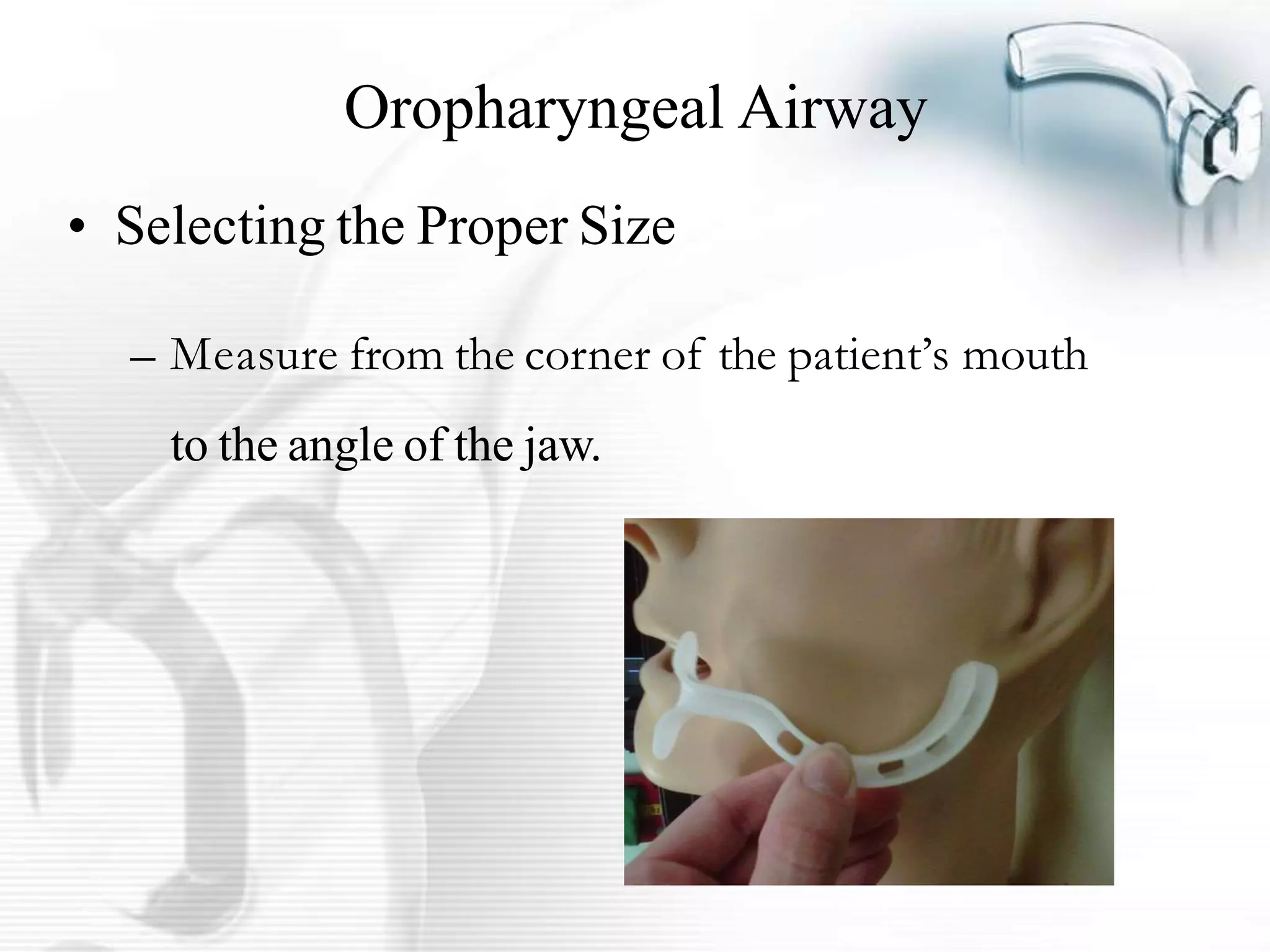 AIRWAY Management.ppt
