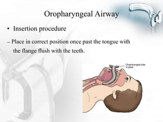 AIRWAY Management.ppt