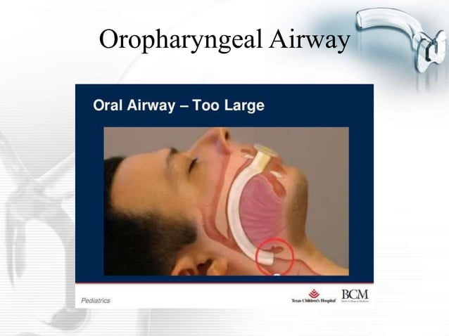 AIRWAY Management.ppt