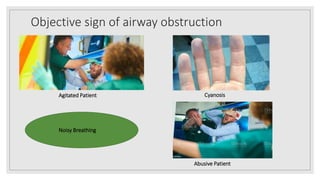 Airway management.pptx