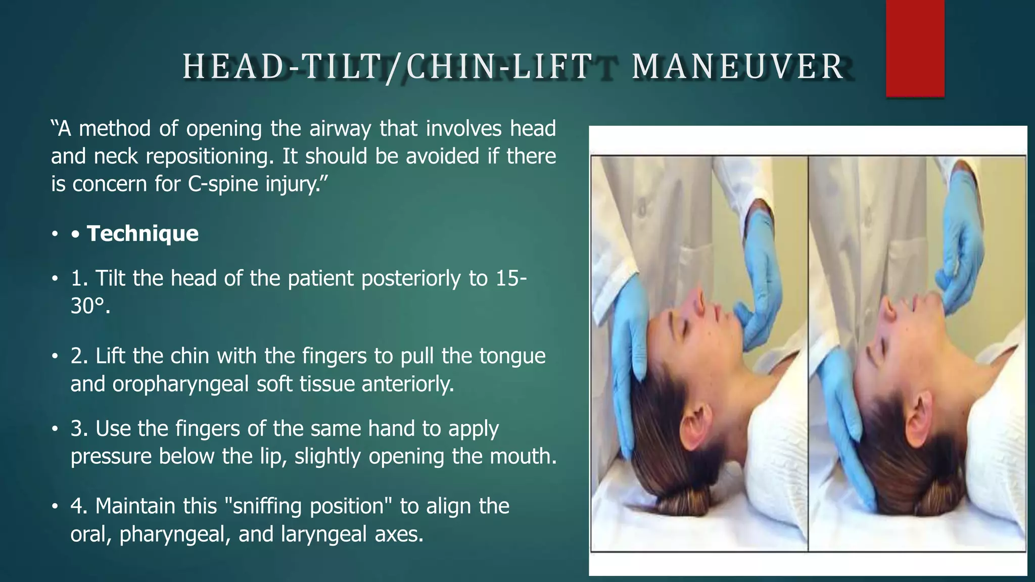 airway management.pptx