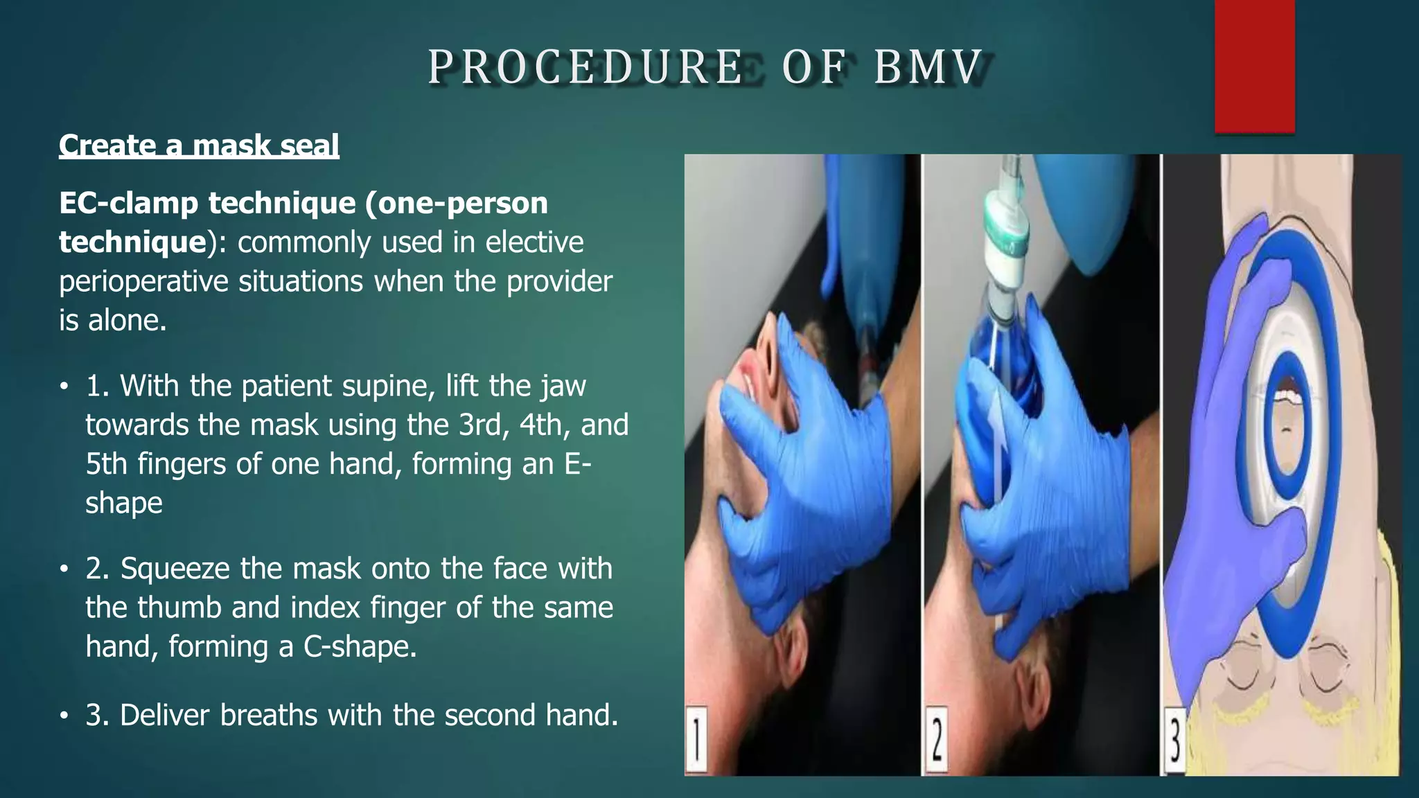 airway management.pptx
