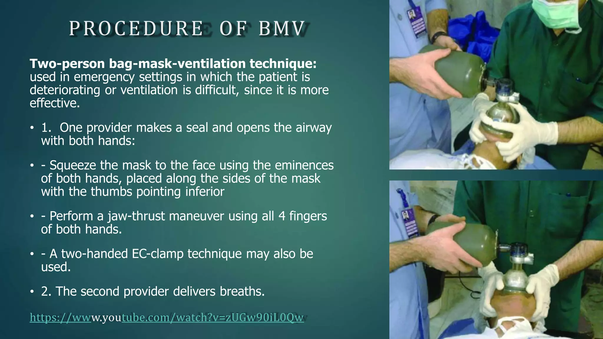 airway management.pptx