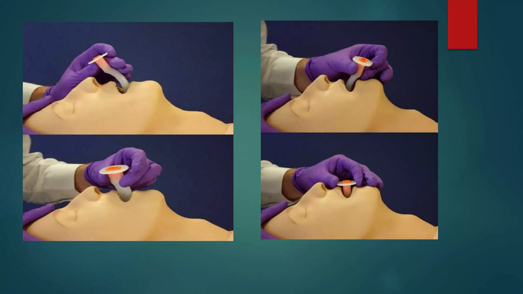 airway management.pptx