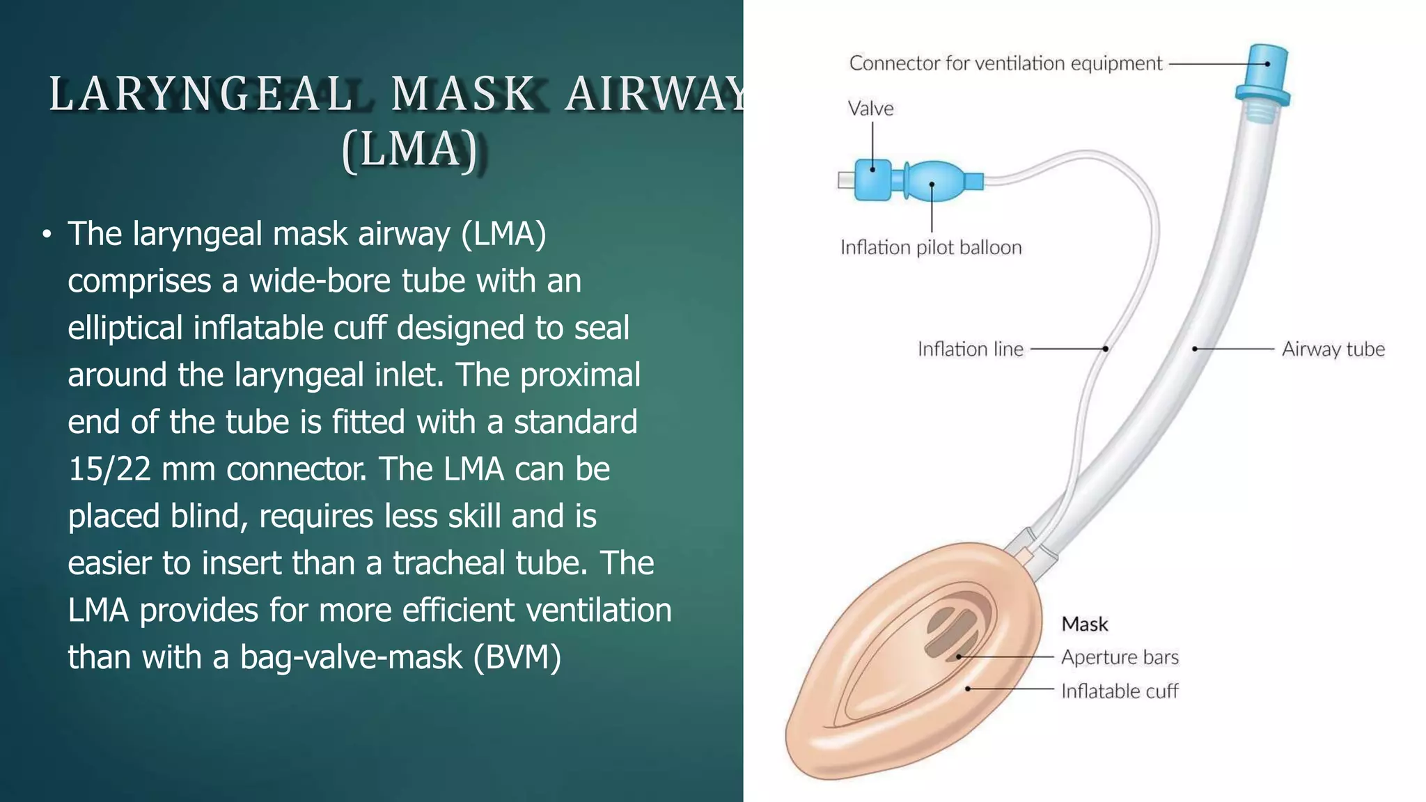 airway management.pptx
