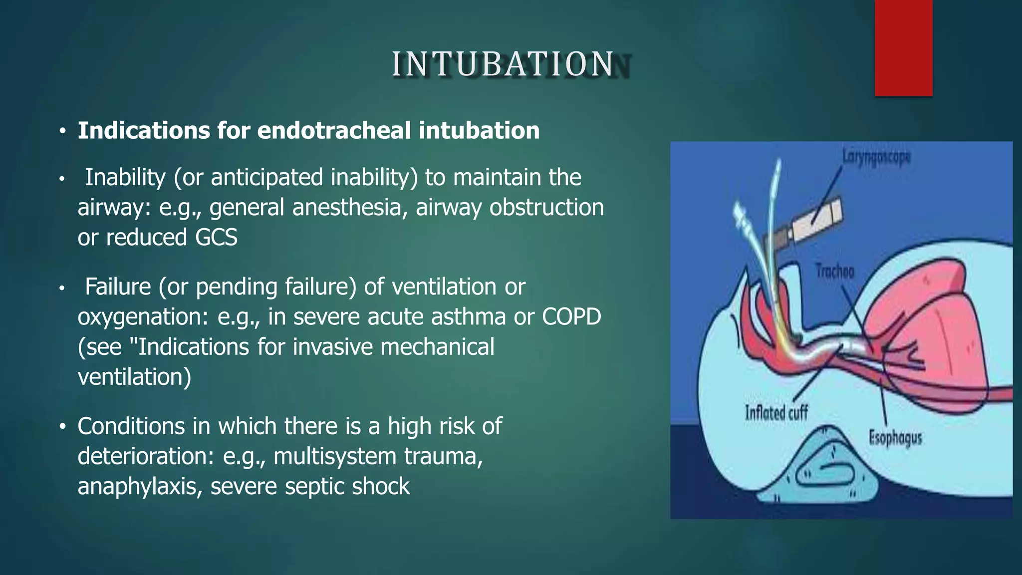 airway management.pptx