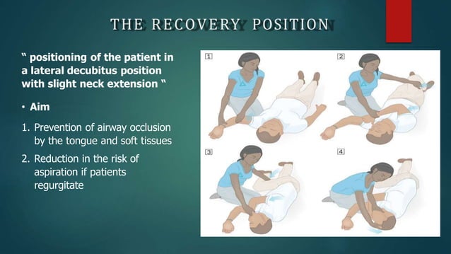 airway management.pptx