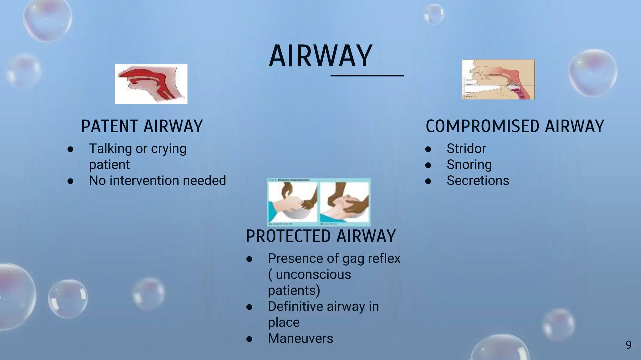 AIRWAY MANAGEMENT .pptx