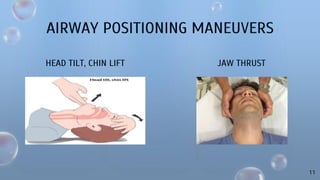 AIRWAY MANAGEMENT .pptx