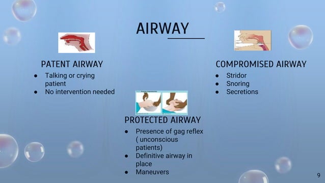 AIRWAY MANAGEMENT .pptx