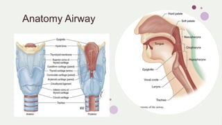 AIRWAY MANAGEMENT slide presentation fix | PPT