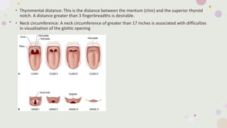 AIRWAY MANAGEMENT slide presentation fix | PPT
