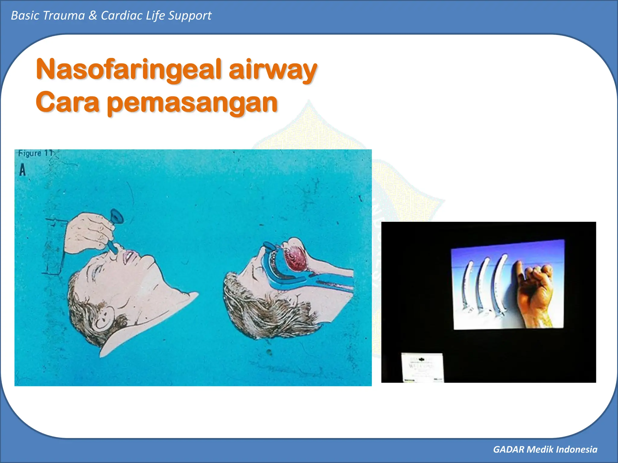 Airway Management .pdf