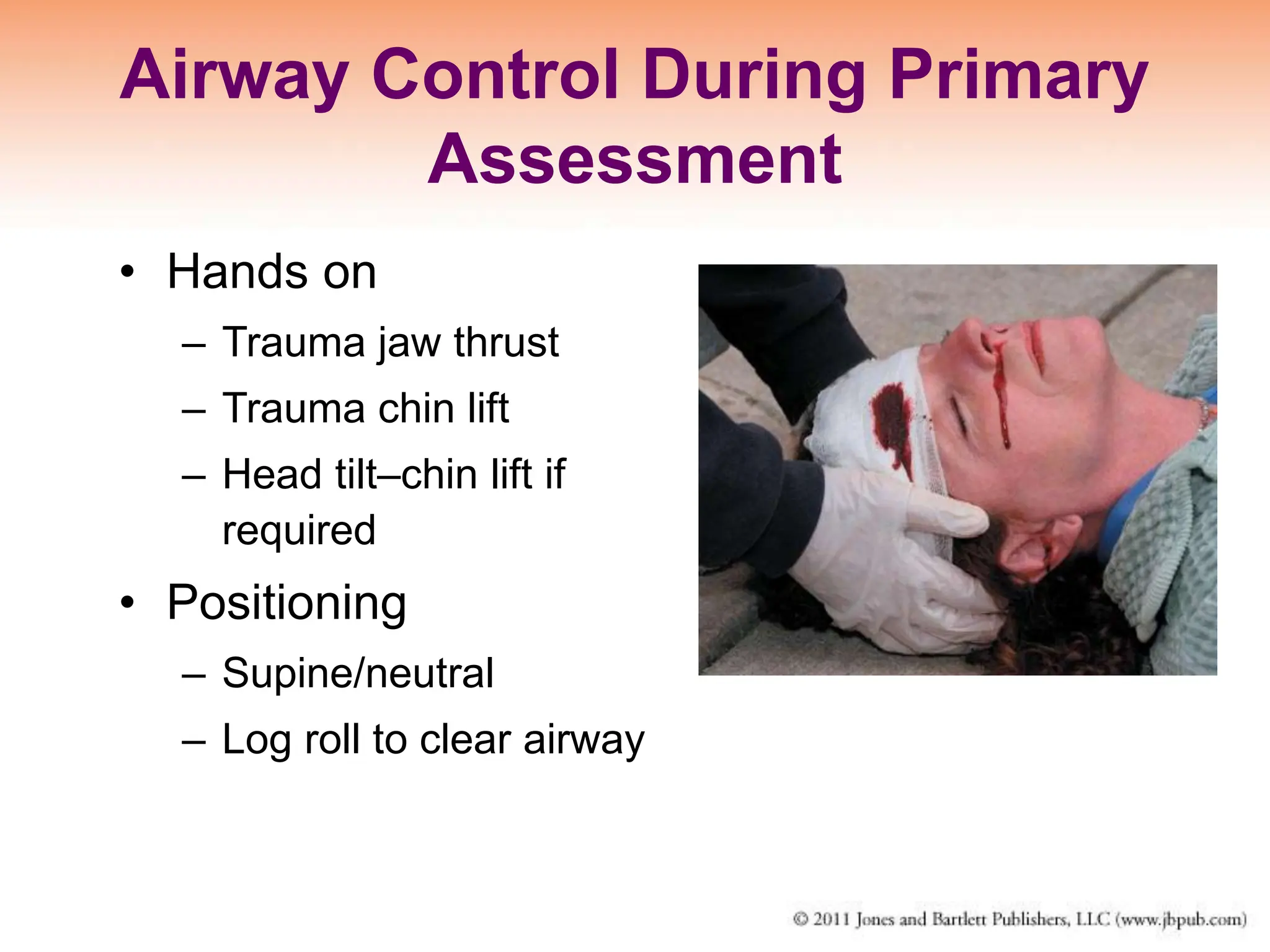Airway Management FreeAirway Management.pptx