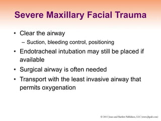 Airway Management FreeAirway Management.pptx