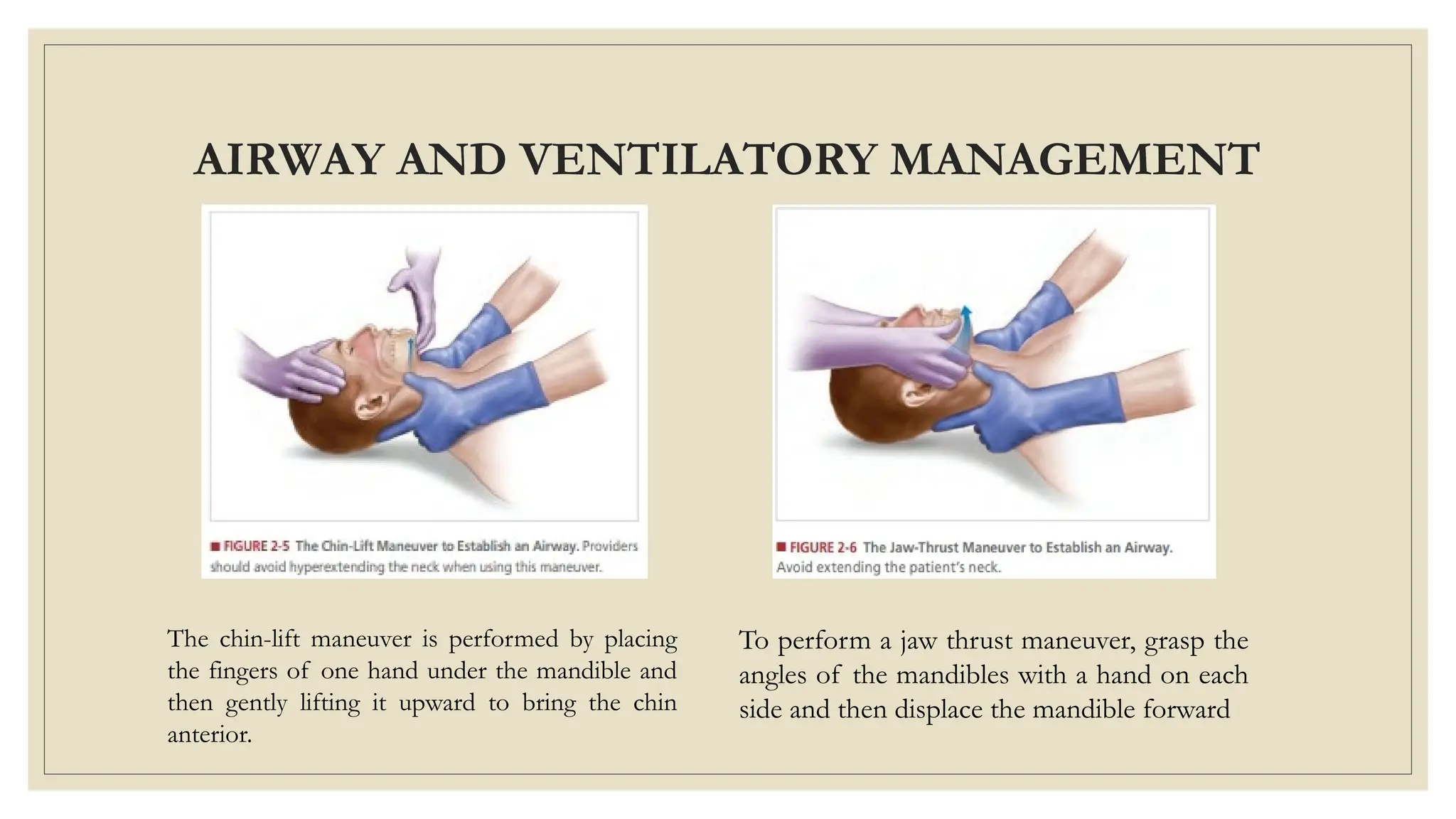 AIRWAY MANAGEMENT on trauma head and thorax case.pptx