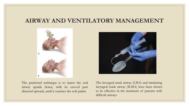 AIRWAY MANAGEMENT on trauma head and thorax case.pptx