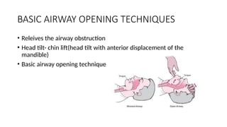 AIRWAY MANAGEMENT in the management of patients | PPTX