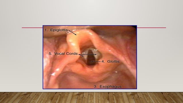 AIRWAY MANAGEMENT.pptx In ent ,tracheostomy | PPT