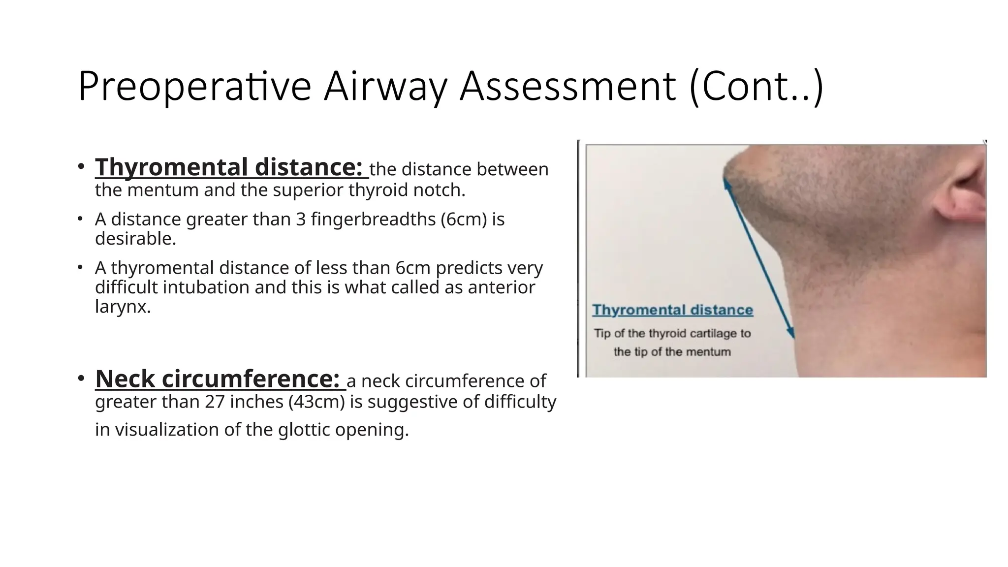 AIRWAY ANATOMY, DIFFICULT INTUBATION, Supraglotic airway devices, Video ...