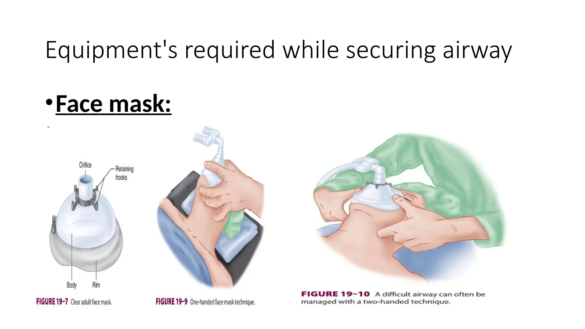 AIRWAY ANATOMY, DIFFICULT INTUBATION, Supraglotic airway devices, Video ...