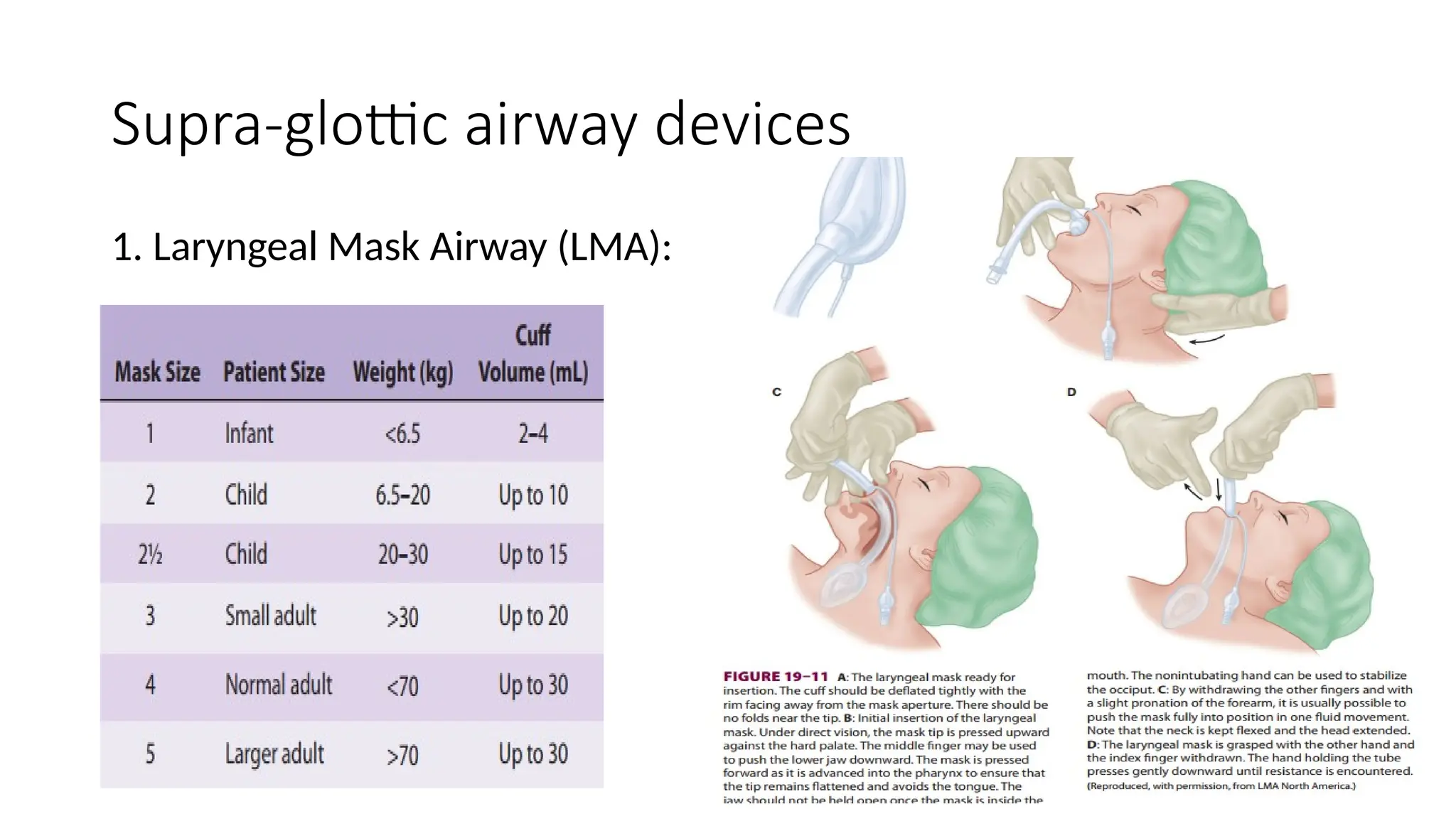 AIRWAY ANATOMY, DIFFICULT INTUBATION, Supraglotic airway devices, Video ...
