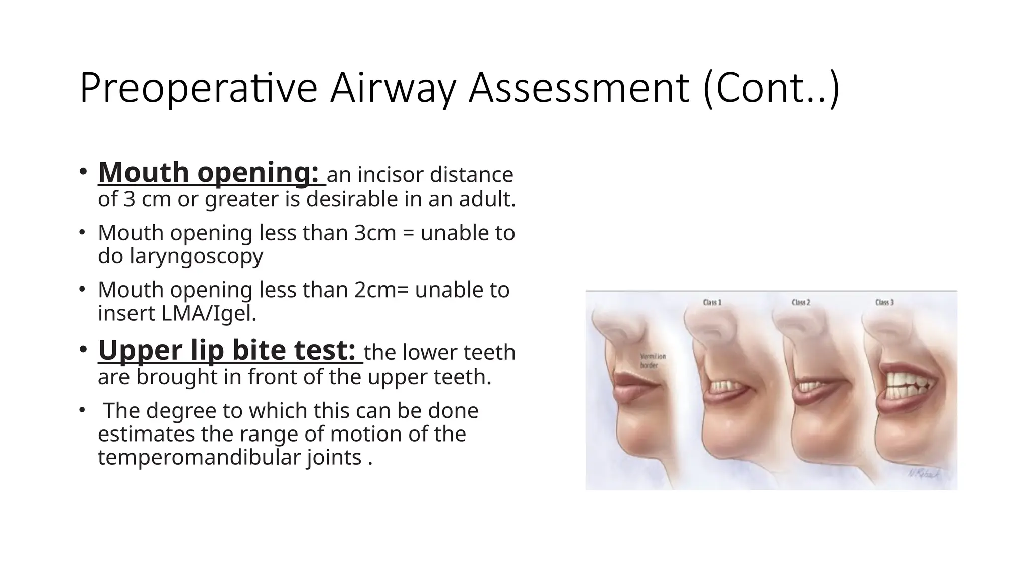 AIRWAY ANATOMY, DIFFICULT INTUBATION, Supraglotic airway devices, Video ...