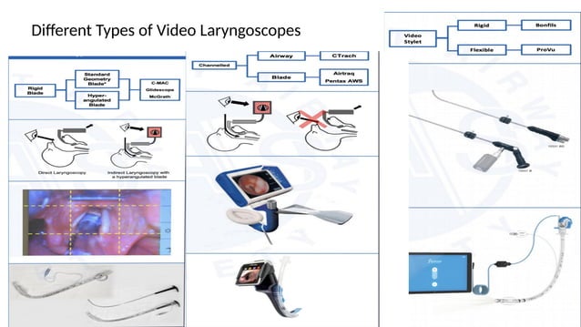 AIRWAY ANATOMY, DIFFICULT INTUBATION, Supraglotic airway devices, Video ...